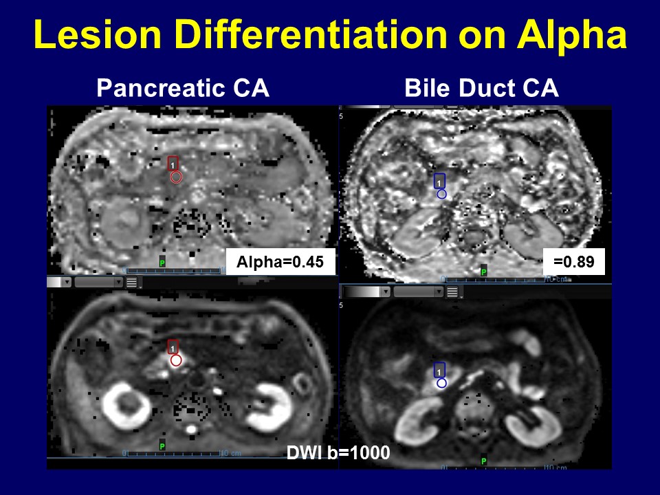 Figure 7. Malignant Lesion Differentiation on Alpha