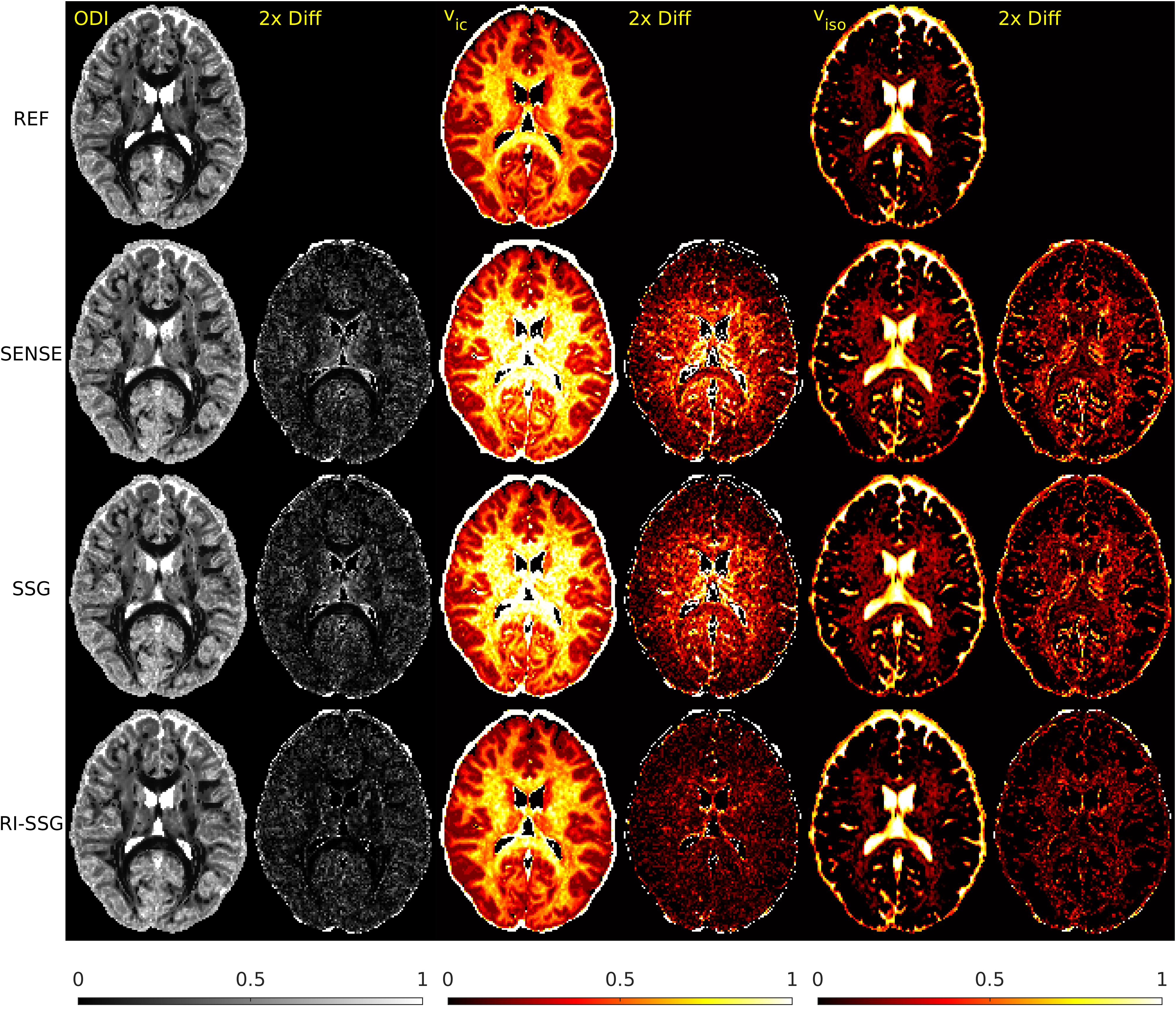 SeyyedKazem HashemizadehKolowri 1 , Rong-Rong Chen 1 , Ganesh Adluru 2 ...