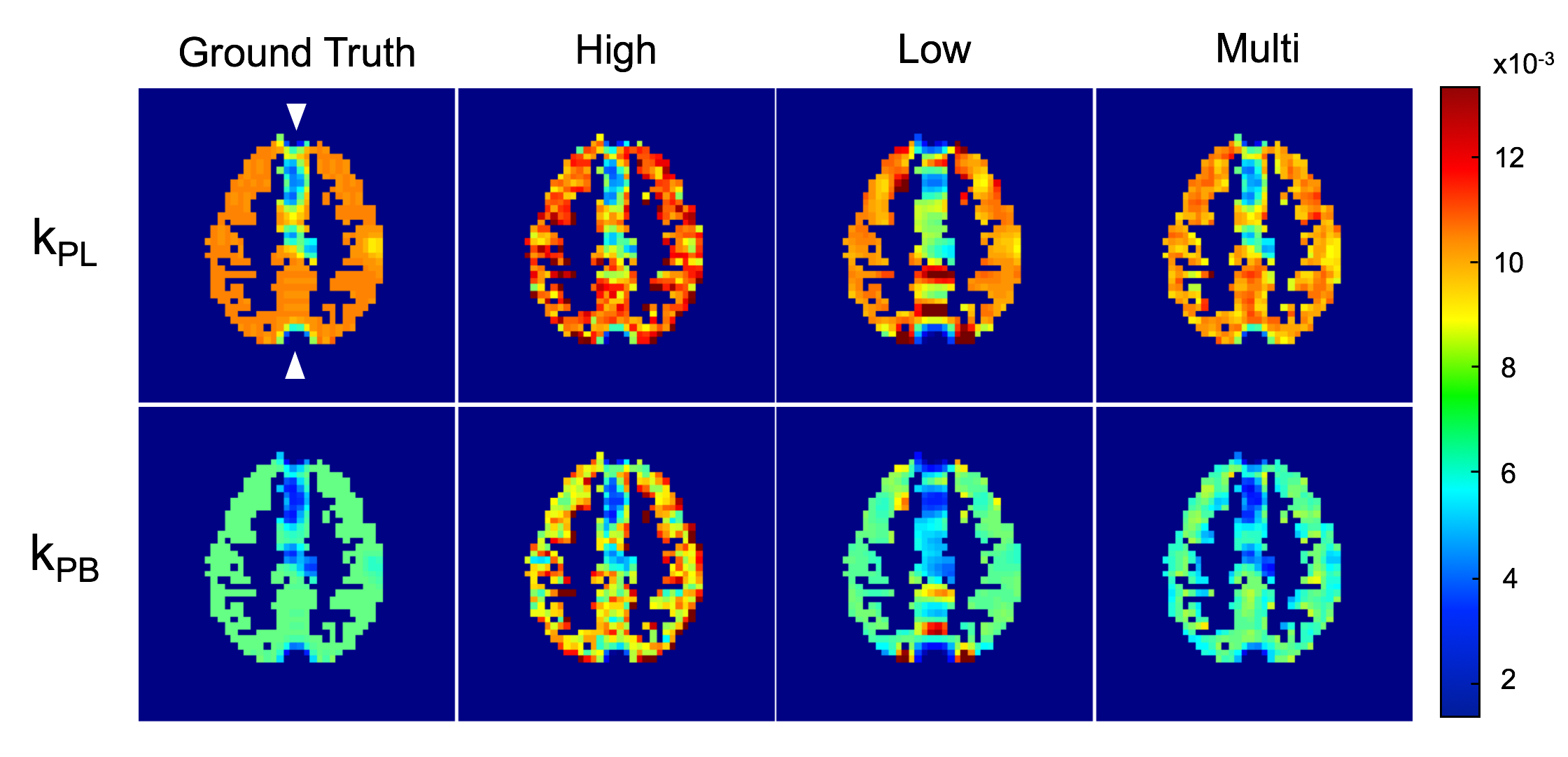 Jasmine Y. Graham 1,2 , Peder E.Z. Larson 2 , Daniel B. Vigneron 2 ...