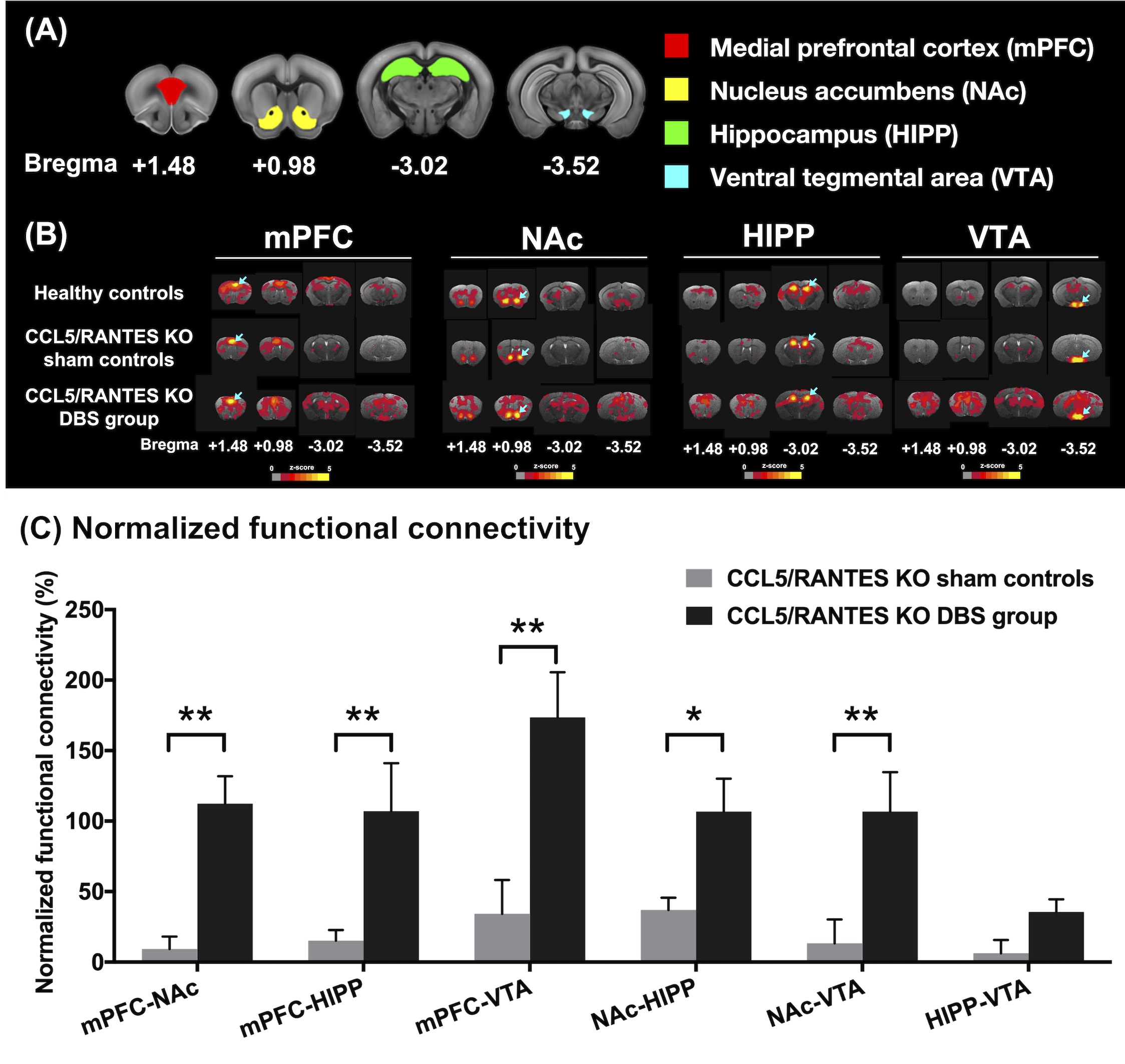 After NAc-DBS in the MetS models,the microstructure and functional ...