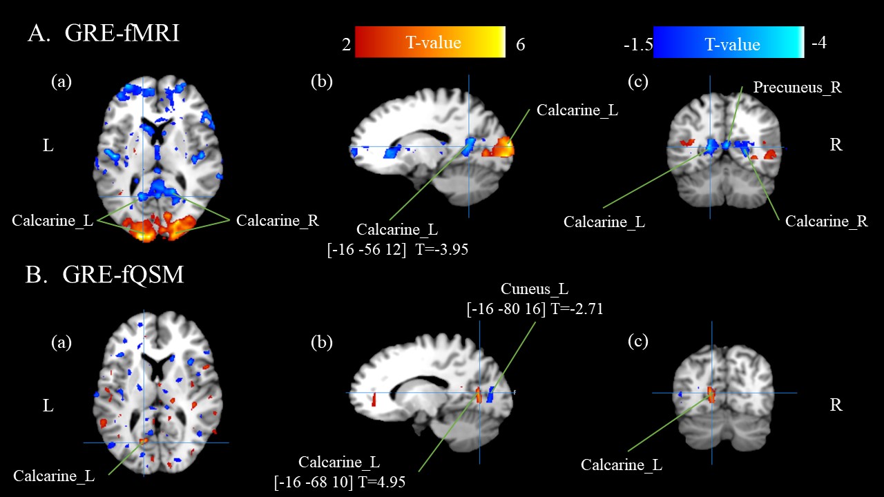 Investigating Human Brain Negative Blood Oxygenation Level Dependent ...