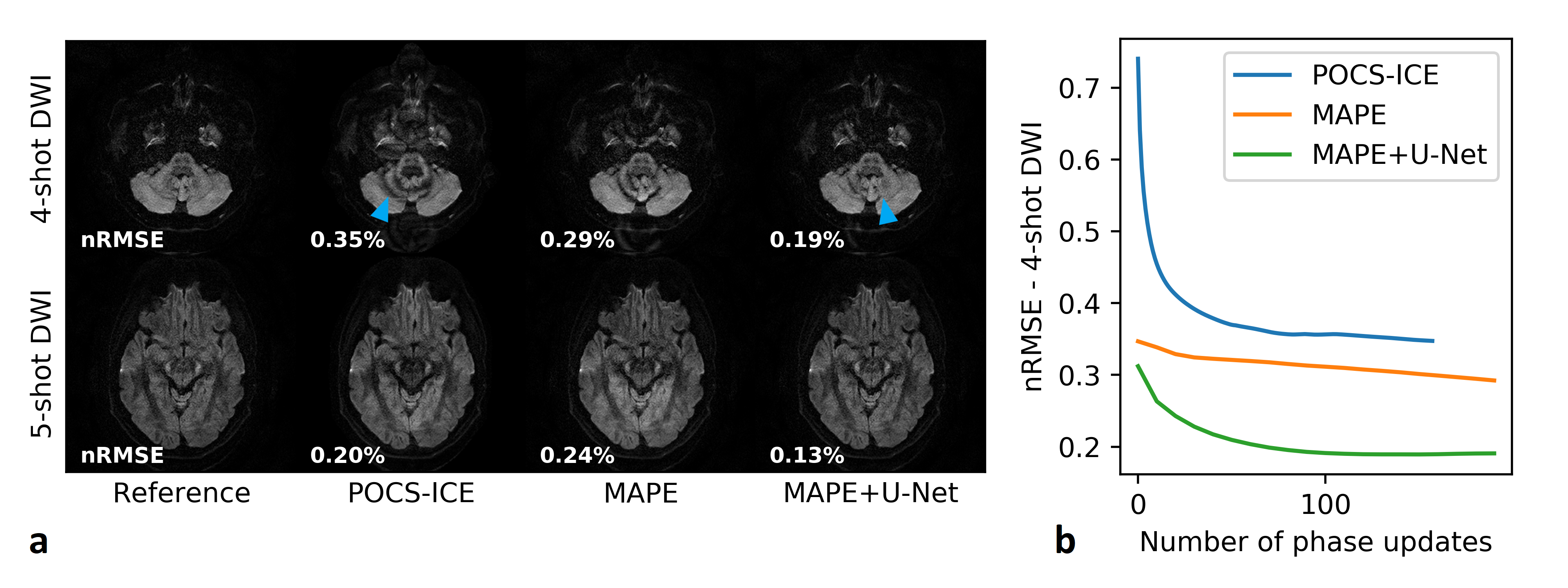 · Multi-shotDWI can be improved by regularizing the phase estimation ...