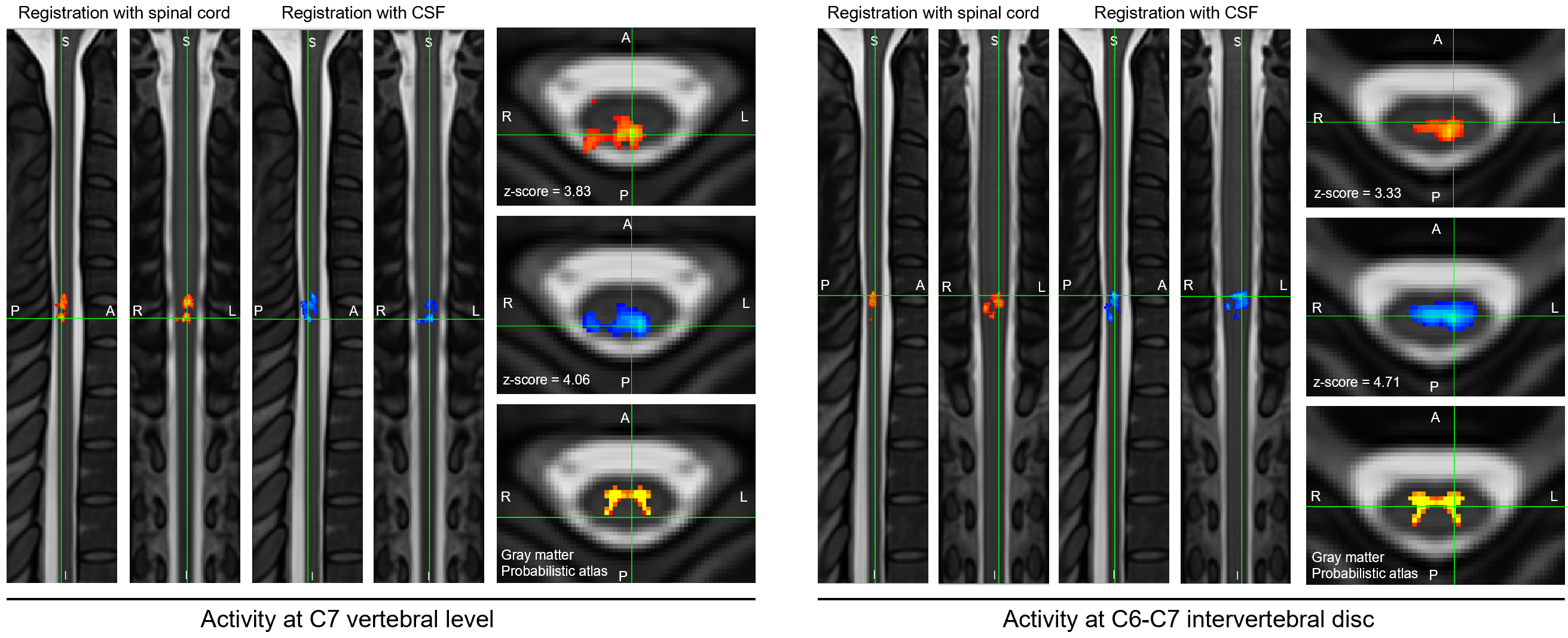 Co-registration of fMRI data using the contrast between the ...
