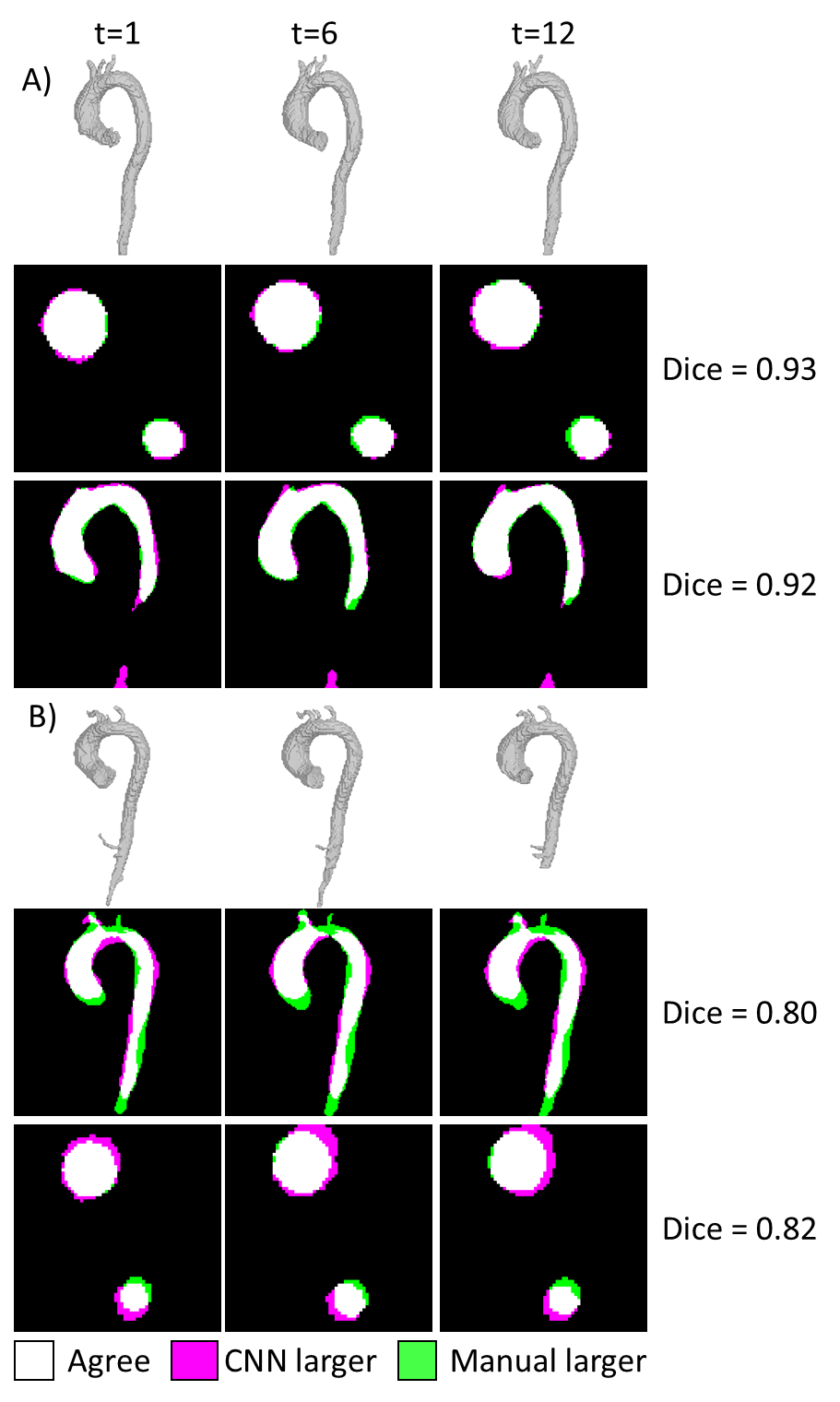 Verification of fully automated deep learning-based 4D segmentation of ...