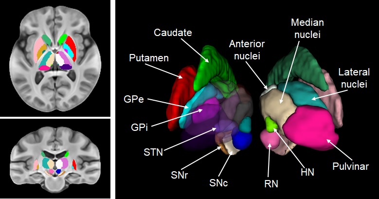 Investigation of subcortical brain structures in patients with ...