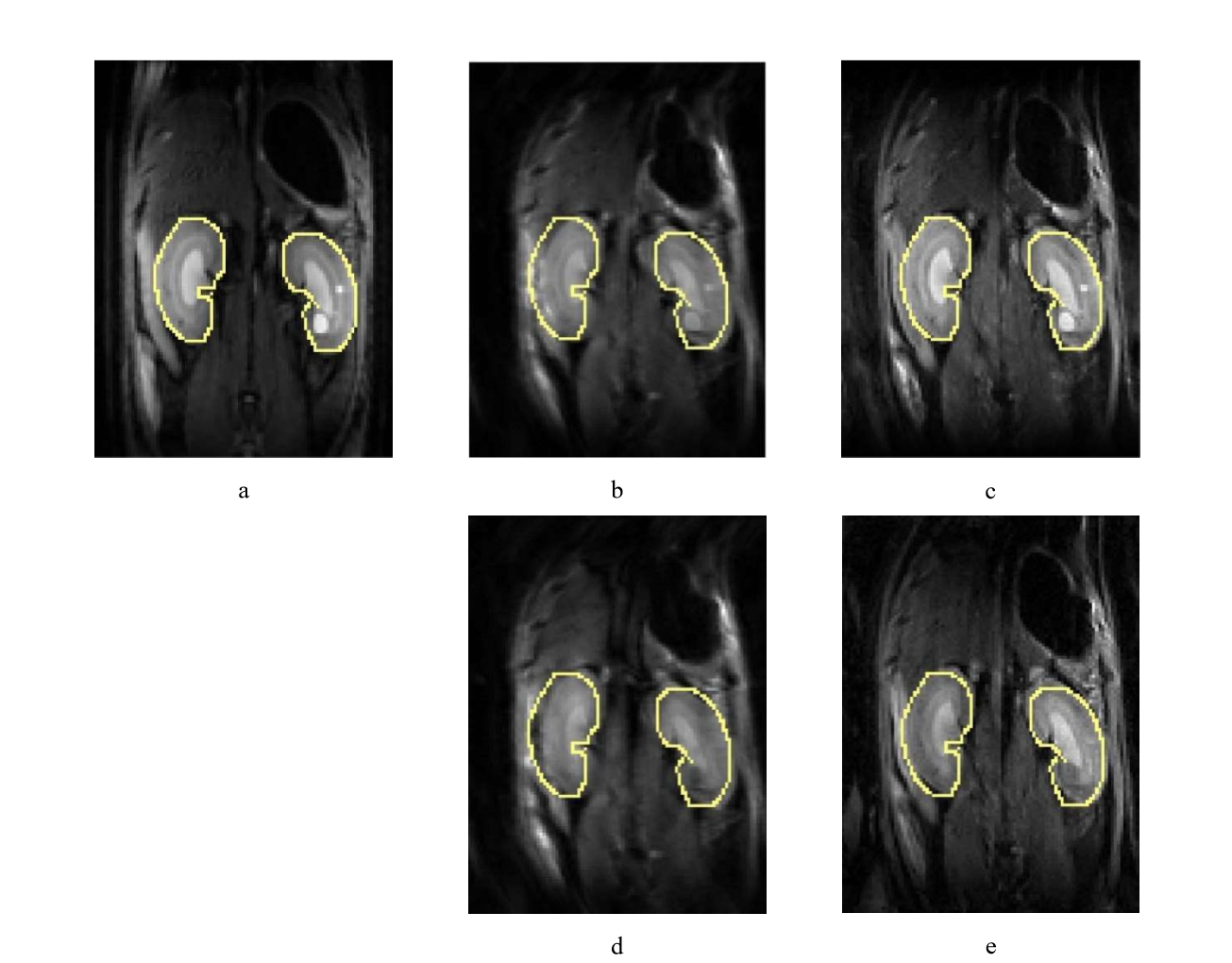 This work aimed toimprove rat kidney diffusion-weighted imaging (DWI ...