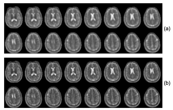 1 Radiology, New York University, New York, NY, United States, 2 ...