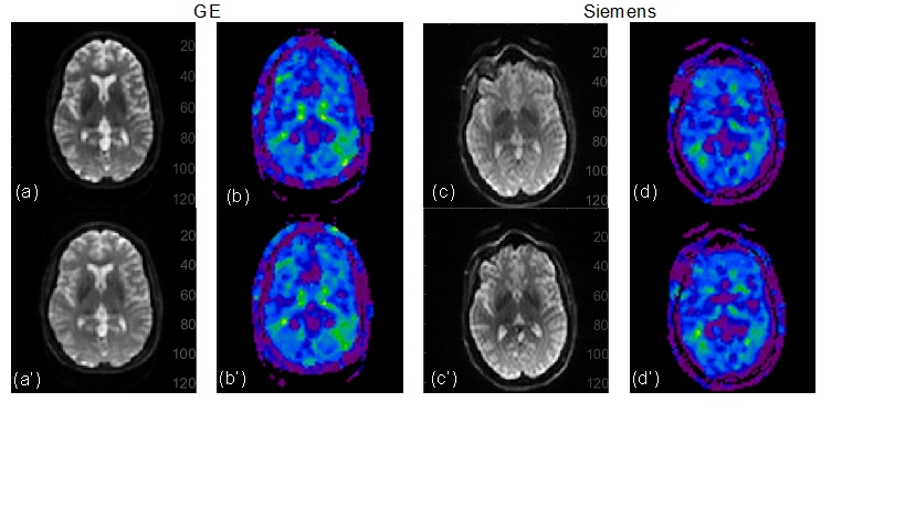 Figure2. Test-retest MRE examples (magnitude and stiffness maps ...