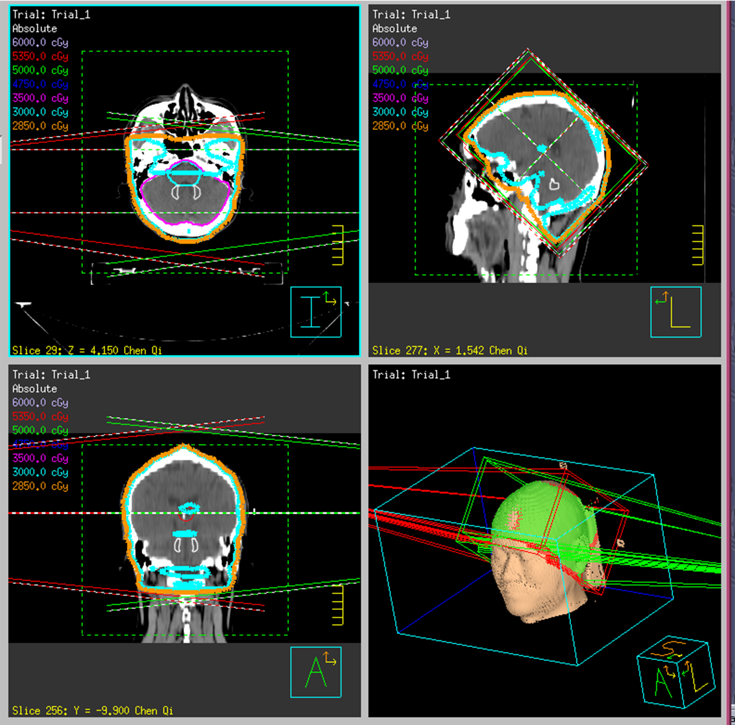SignalIntensity in Dentate Nucleus on Unenhanced T1-weighted MR Images ...