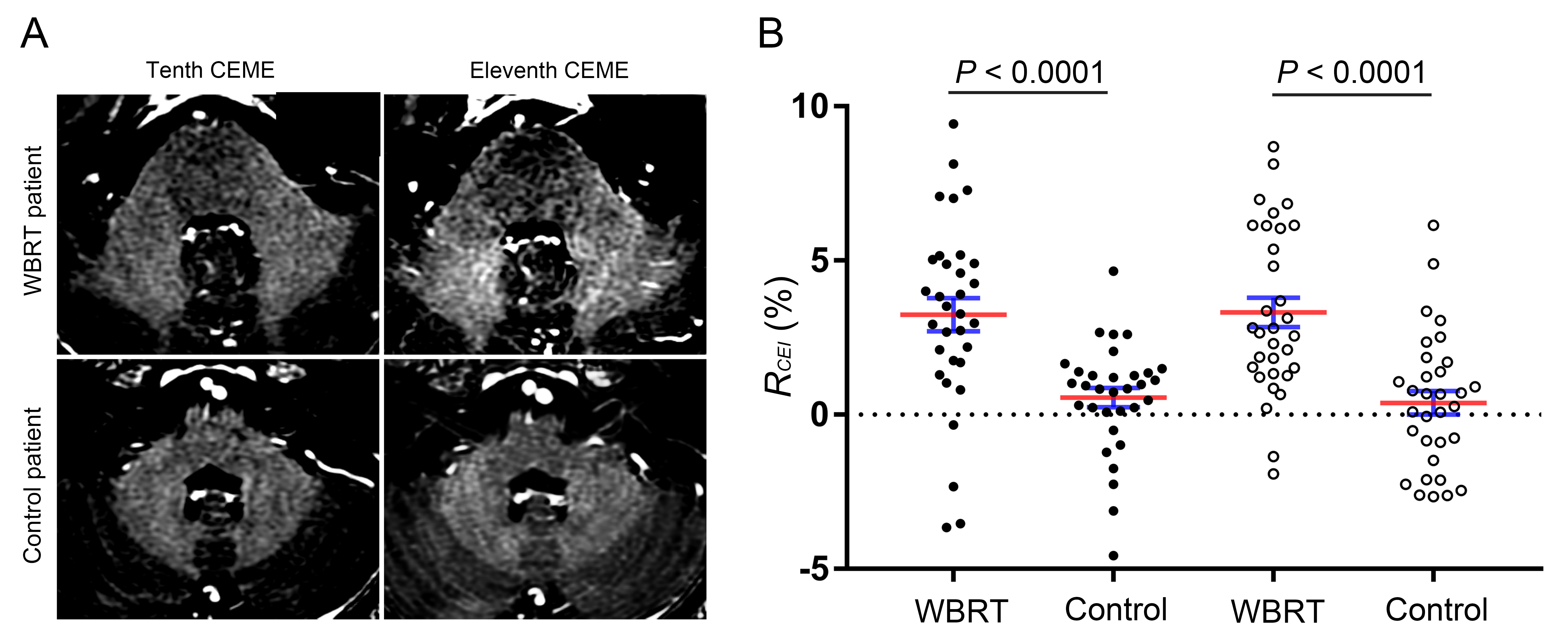 1 Ruijin Hospital, Shanghai, China, 2 Ruijin Hosptial, Shanghai, China ...