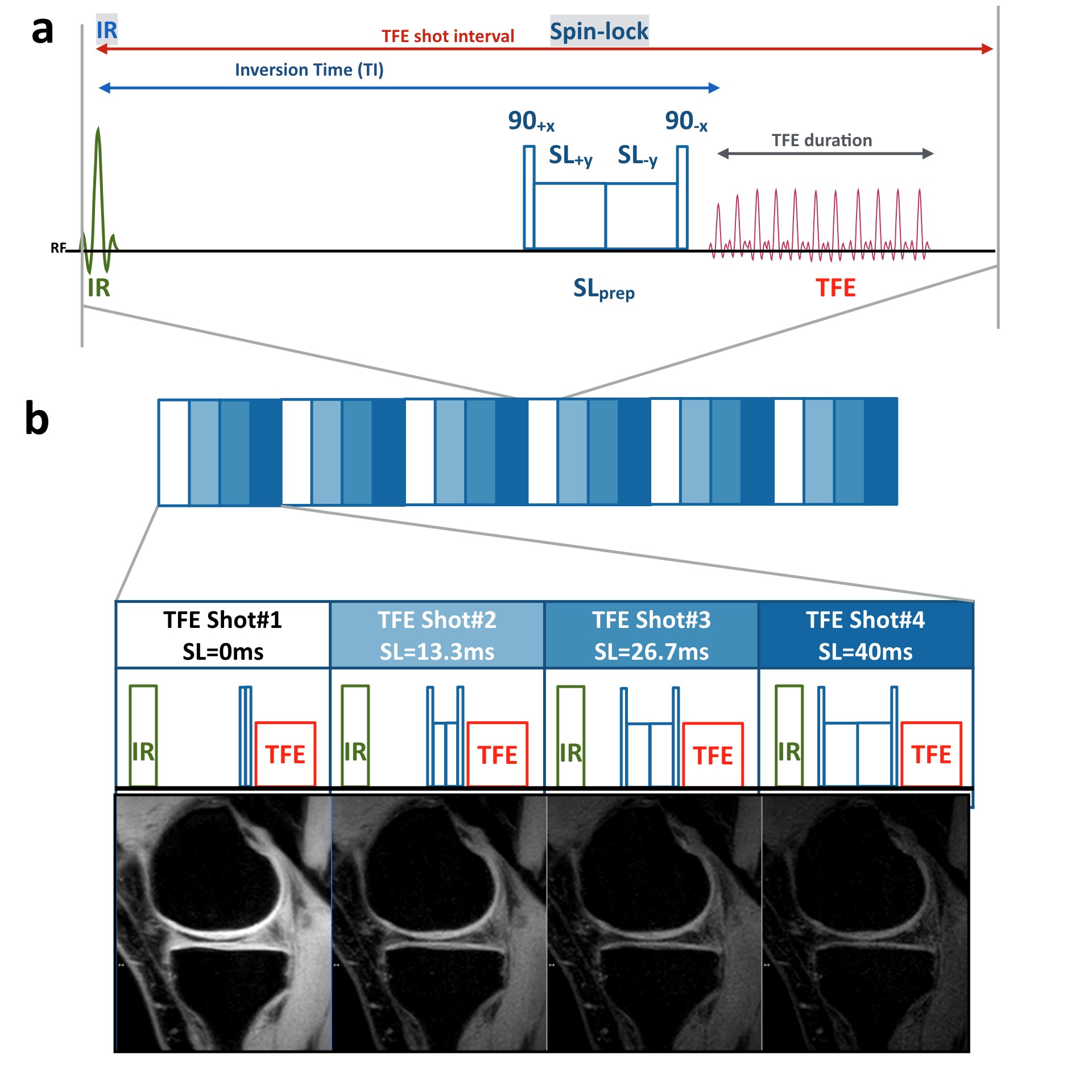 1 Saitama Medical University, Saitama, Japan, 2 Philips Japan, Tokyo, Japan