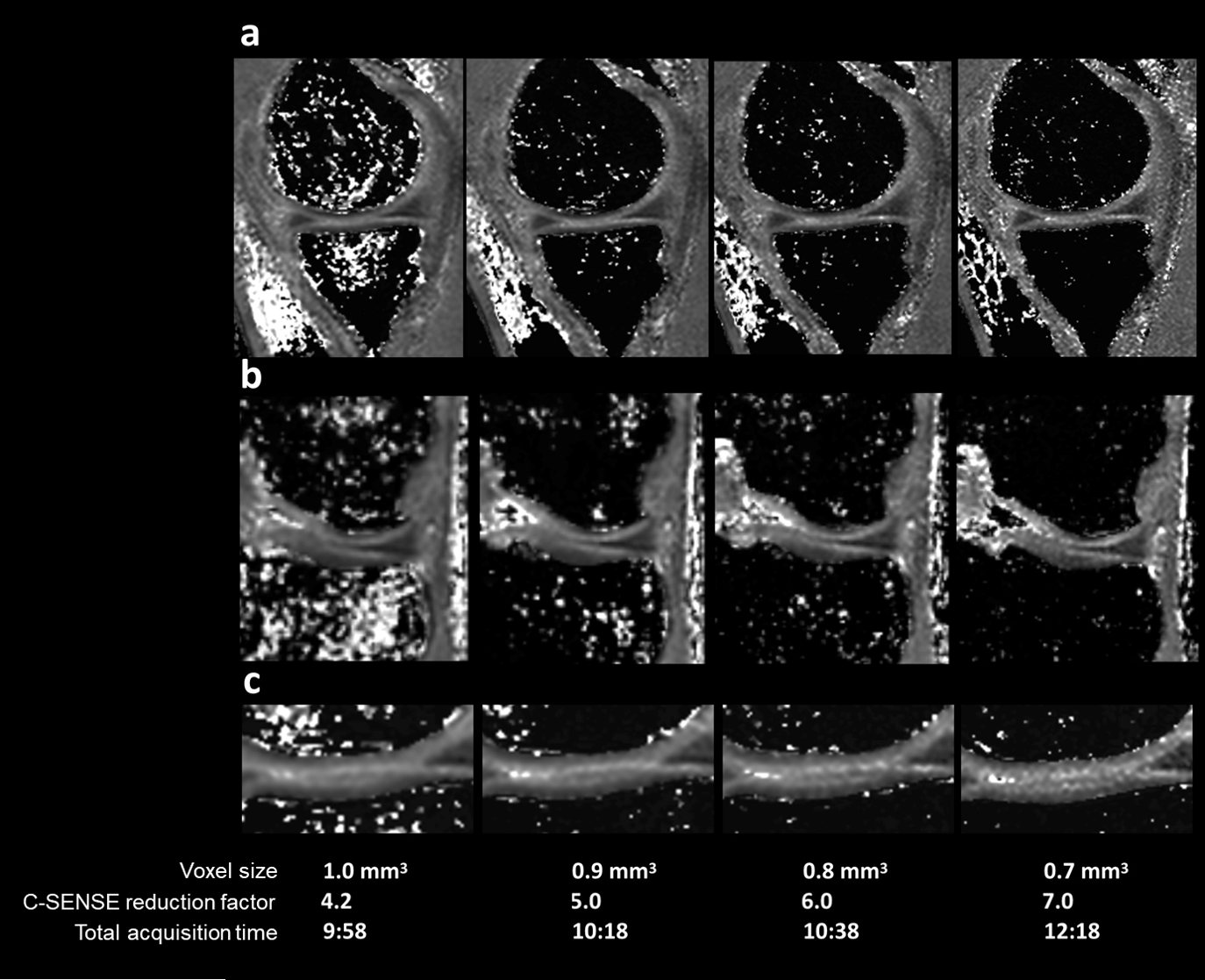 1 Saitama Medical University, Saitama, Japan, 2 Philips Japan, Tokyo, Japan