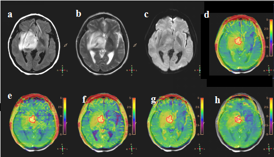 1 The First Affiliated Hospital of Dalian Medical University, Dalian ...