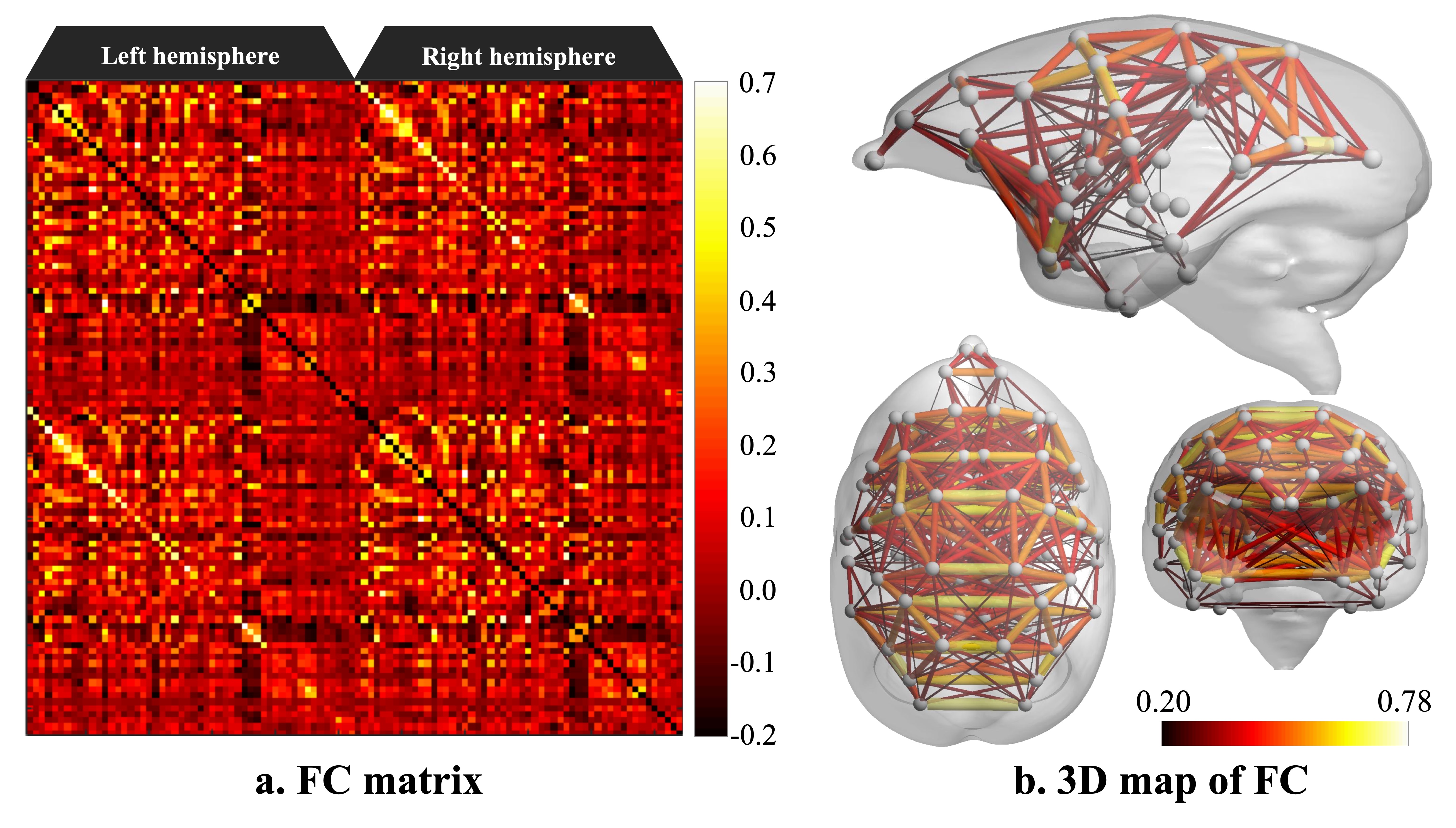 Figure 2. Functional connectivity matrix and 3D map of resting-state ...