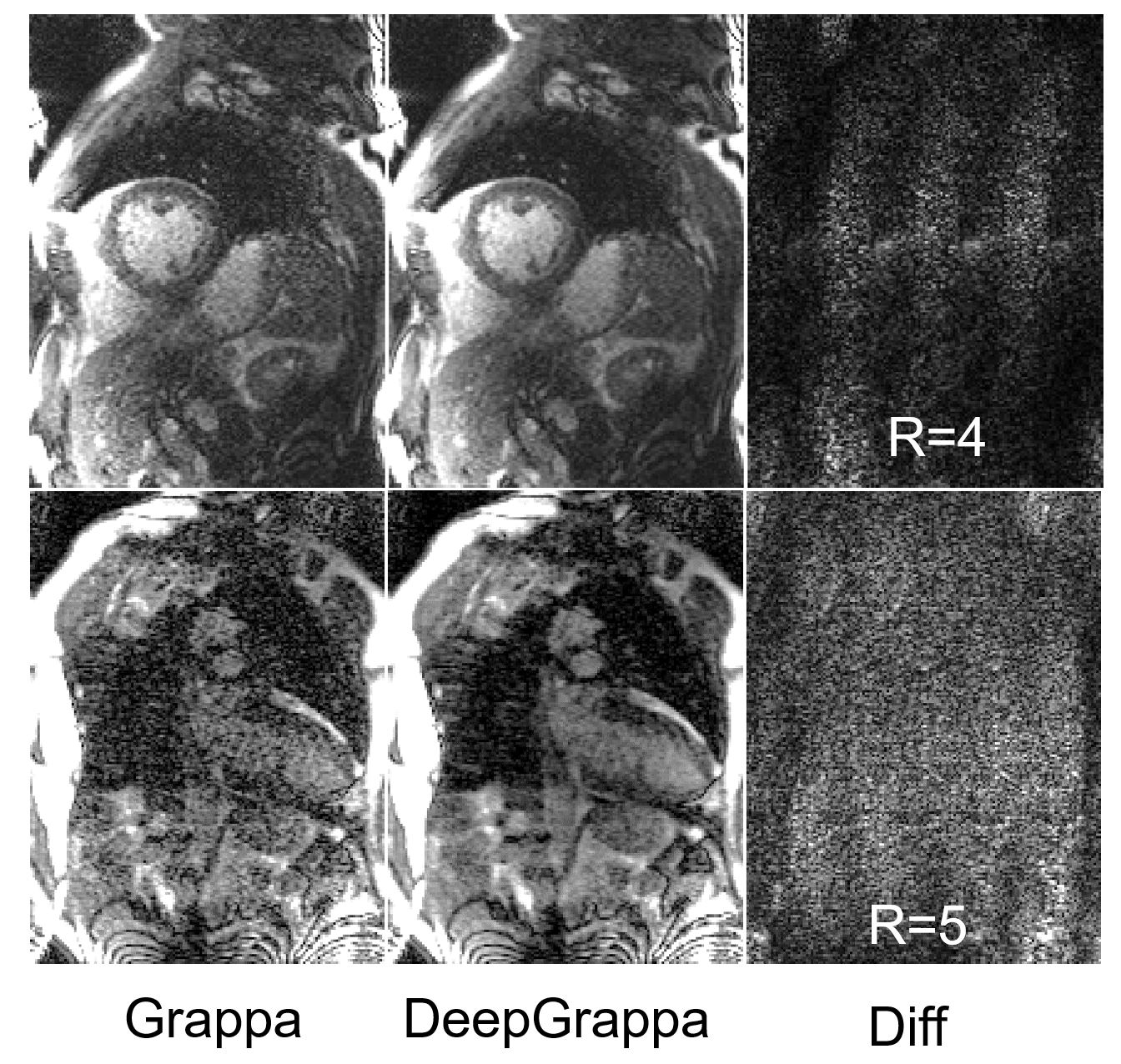 DeepGrappa , a novel Self-Calibrated deep learning MR reconstruction ...