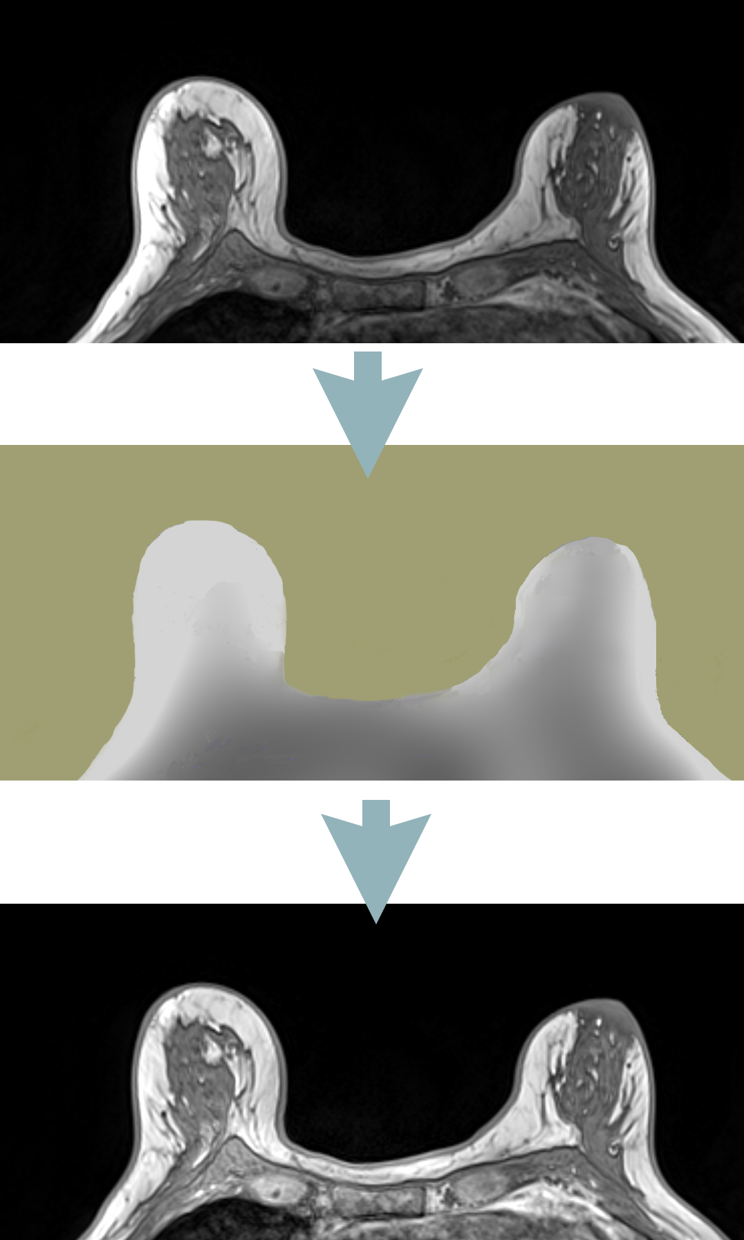 Fig.1. Both N4 and BiCal methods model non-uniformity by ...