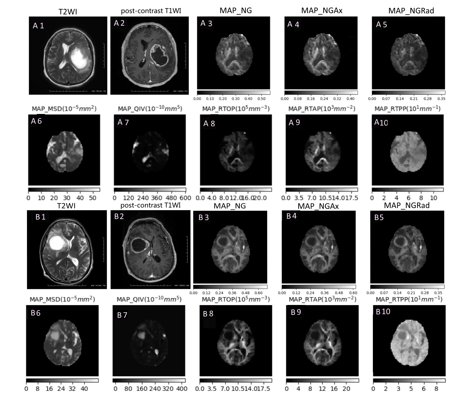 Figure 1. A1-A10 and B1-B10 show neuroanatomical variation of MAP-MRI ...
