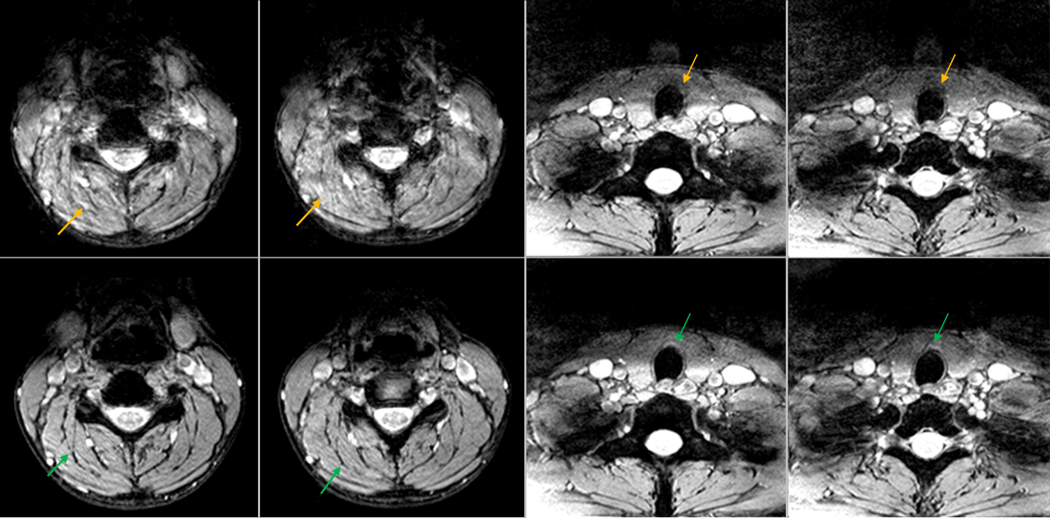 Fig 1. Diagram of the proposed MEDIC sequence with navigator