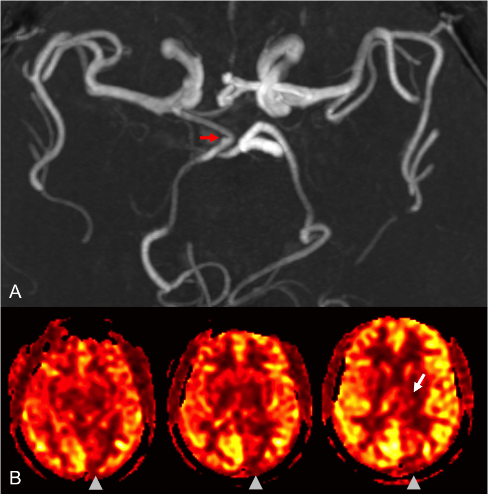 1 Department of Radiology, University of California, San Diego, San ...