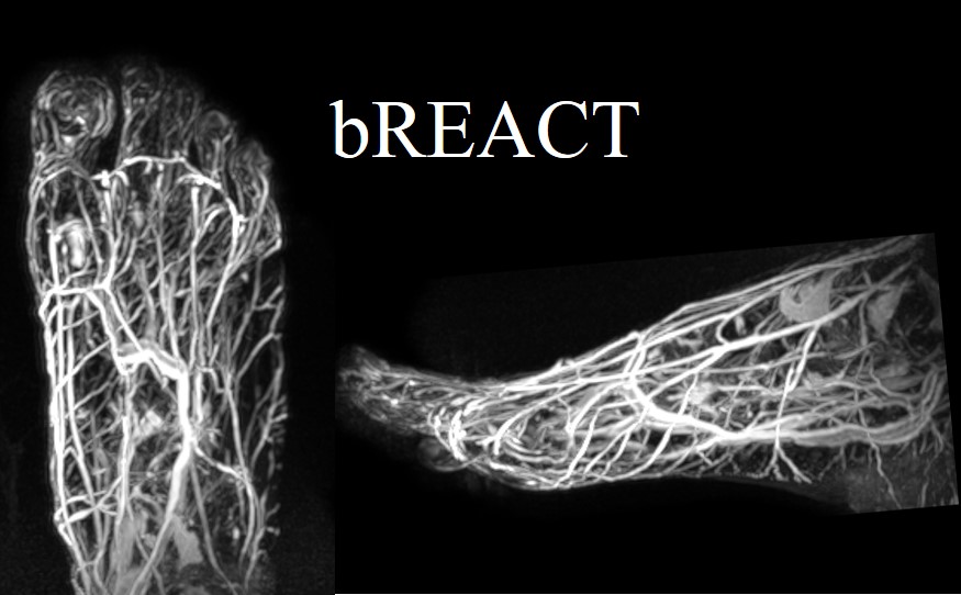 Figure 4. Representative bREACT MRA of thefoot. bREACTcould visualize ...