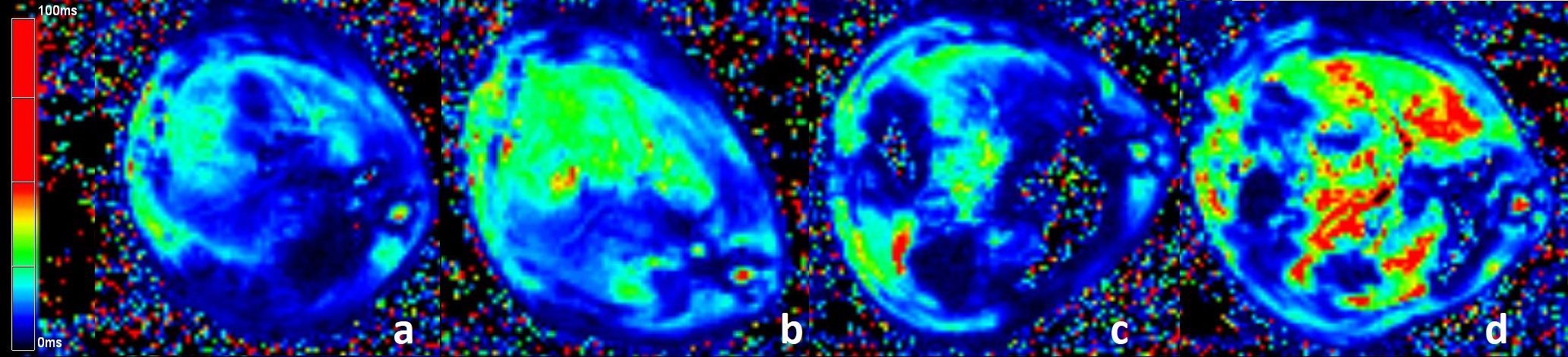 T2* relaxation time can be used to monitor changesin liver arterial ...