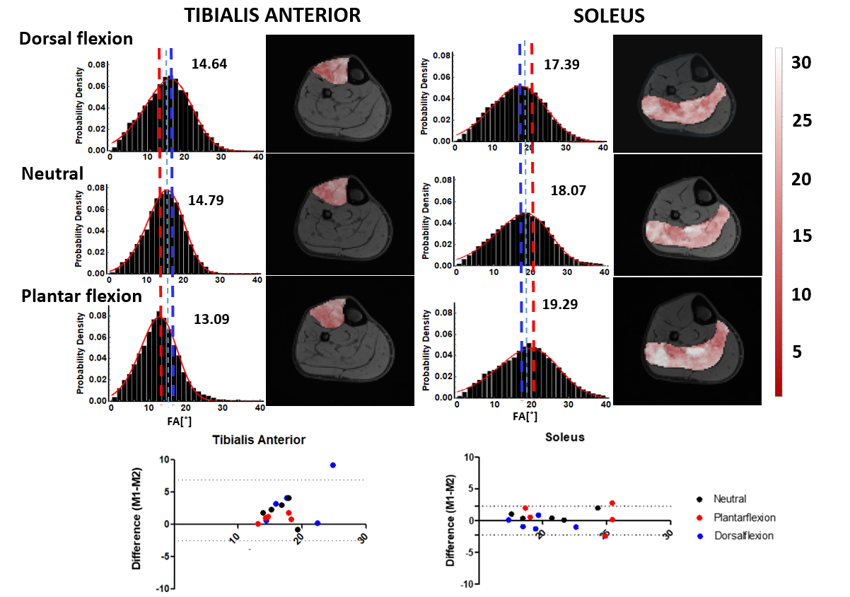 A method for quantification of changes in leg muscle fiber orientations
