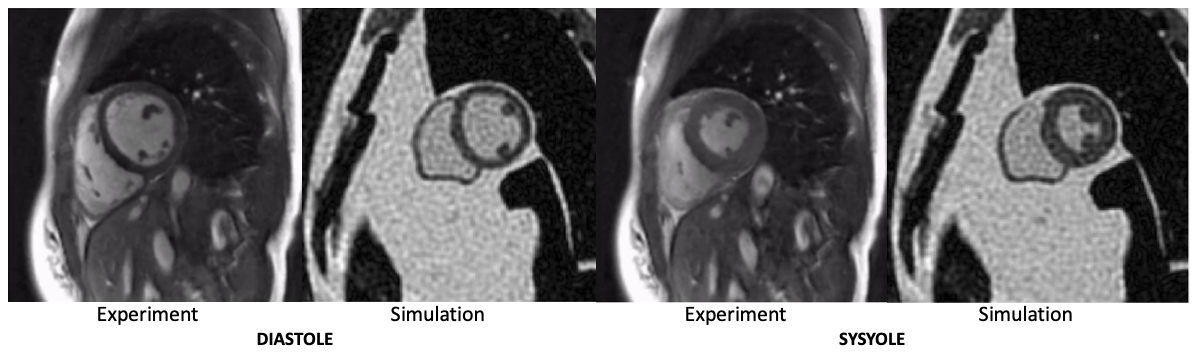 FIGURE 2 – Visual comparison of experiment and simulated short-axis ...