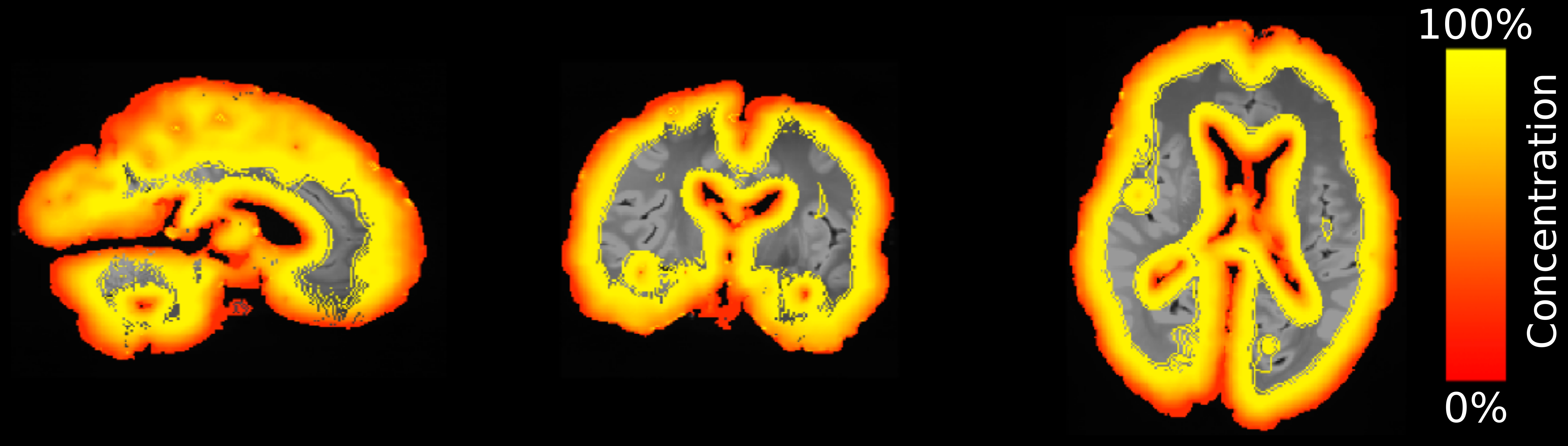 A method to remove the influence of fixative concentration on post ...