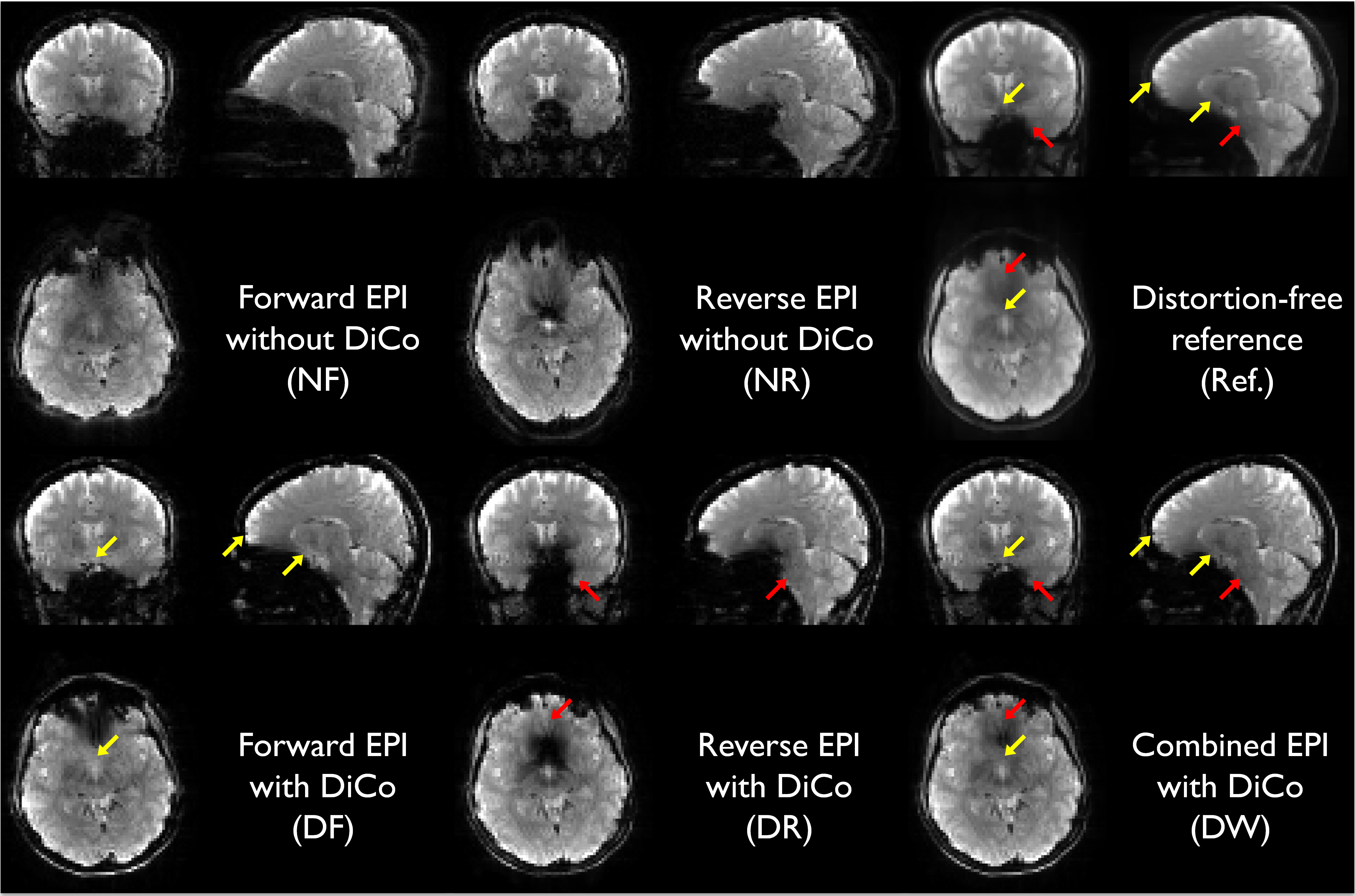 Initial feasibility of a multi-band PSF-mappingbased, reverse-gradient ...