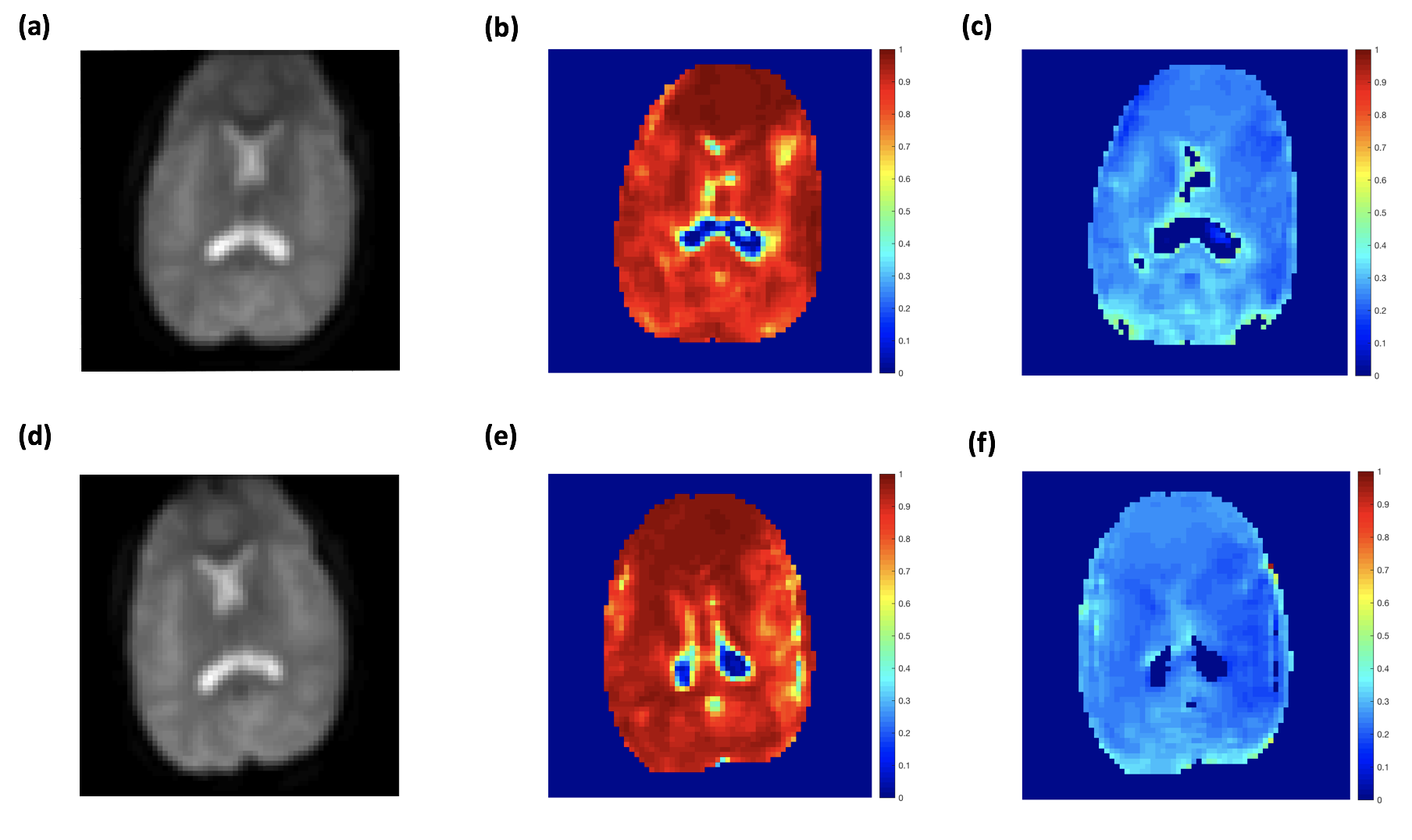 This study demonstrated tissue oxygen extraction change in patients ...