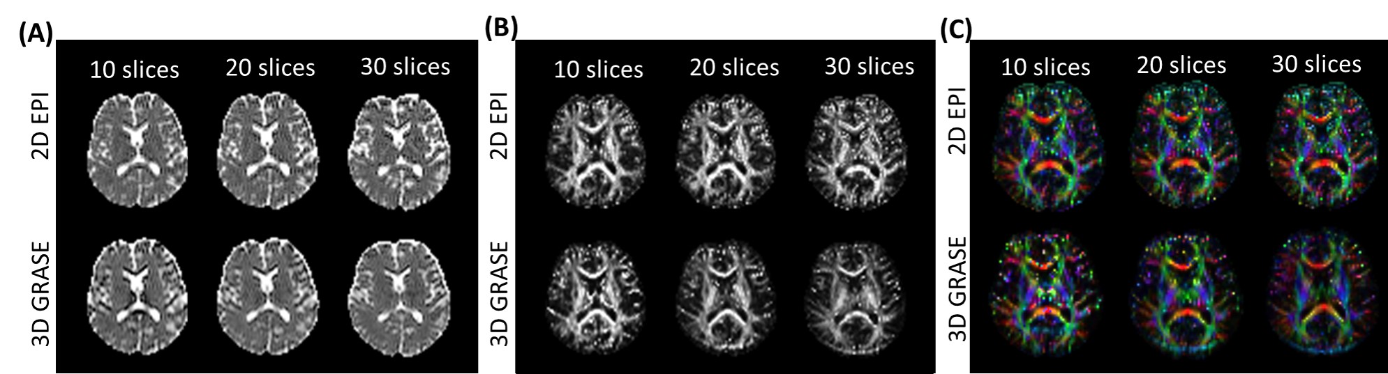 Figure 1.Diagram of the 3D OGprep-GRASE sequence, which contains a ...
