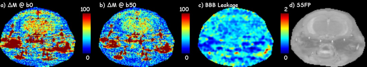 Figure 3 Representative ΔM maps (a.u.) at 400ms with b‑values of a ...