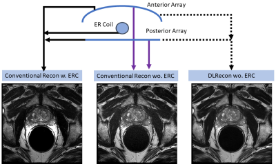 Deep learning based reconstruction (DL Recon) enables highresolution ...