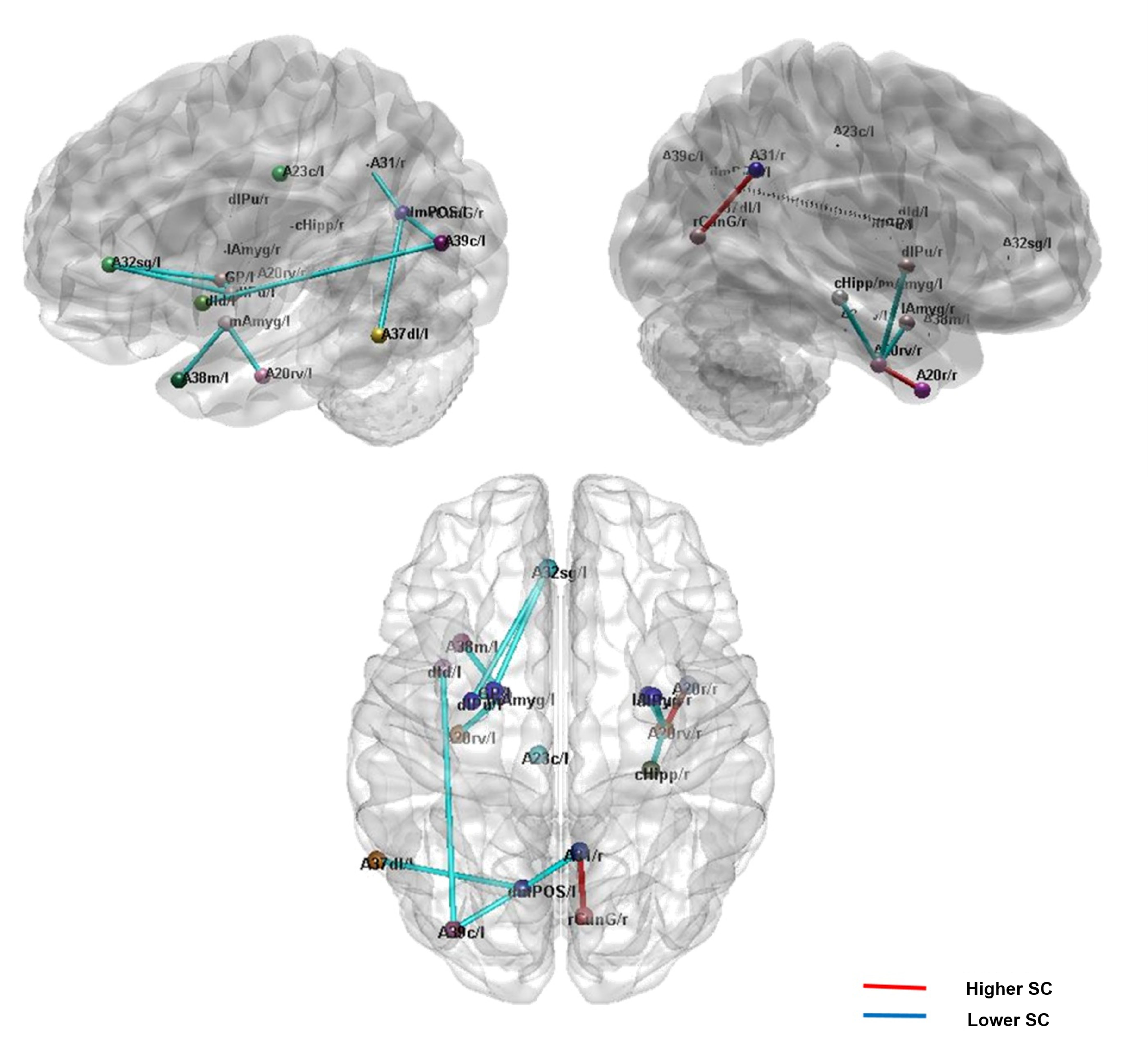 This study demonstrated the subregion scheme of the precuneus that ...