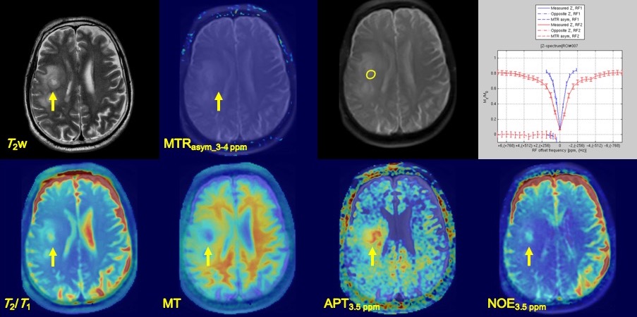 CEST imaging with multi-pool Bloch equation model was demonstrated for ...