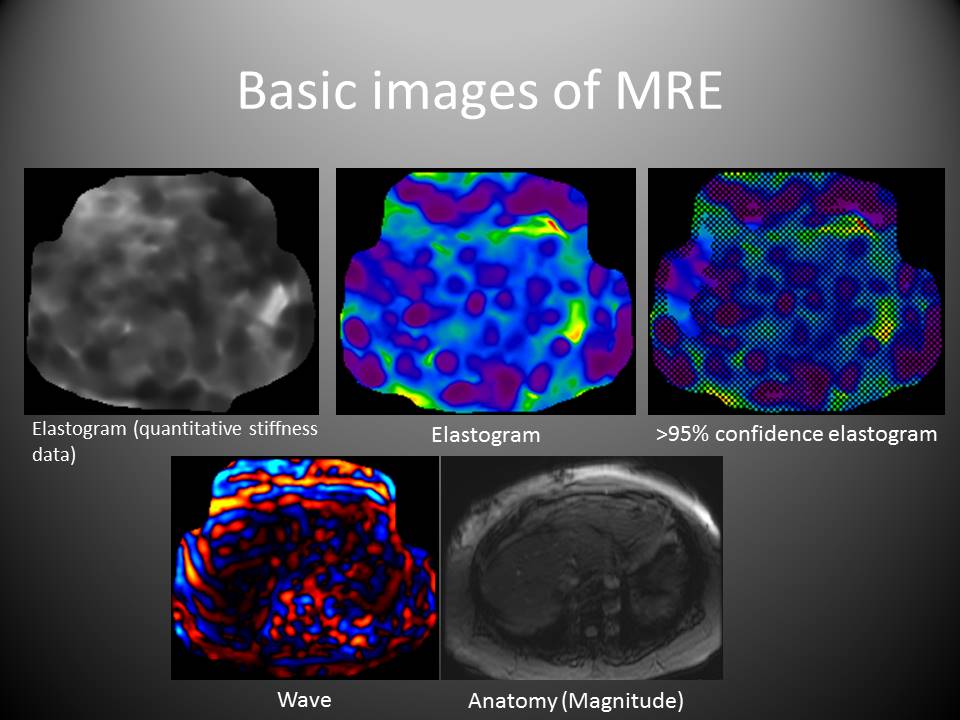 Sample slide from the liverMR elastography quality control tutorial ...