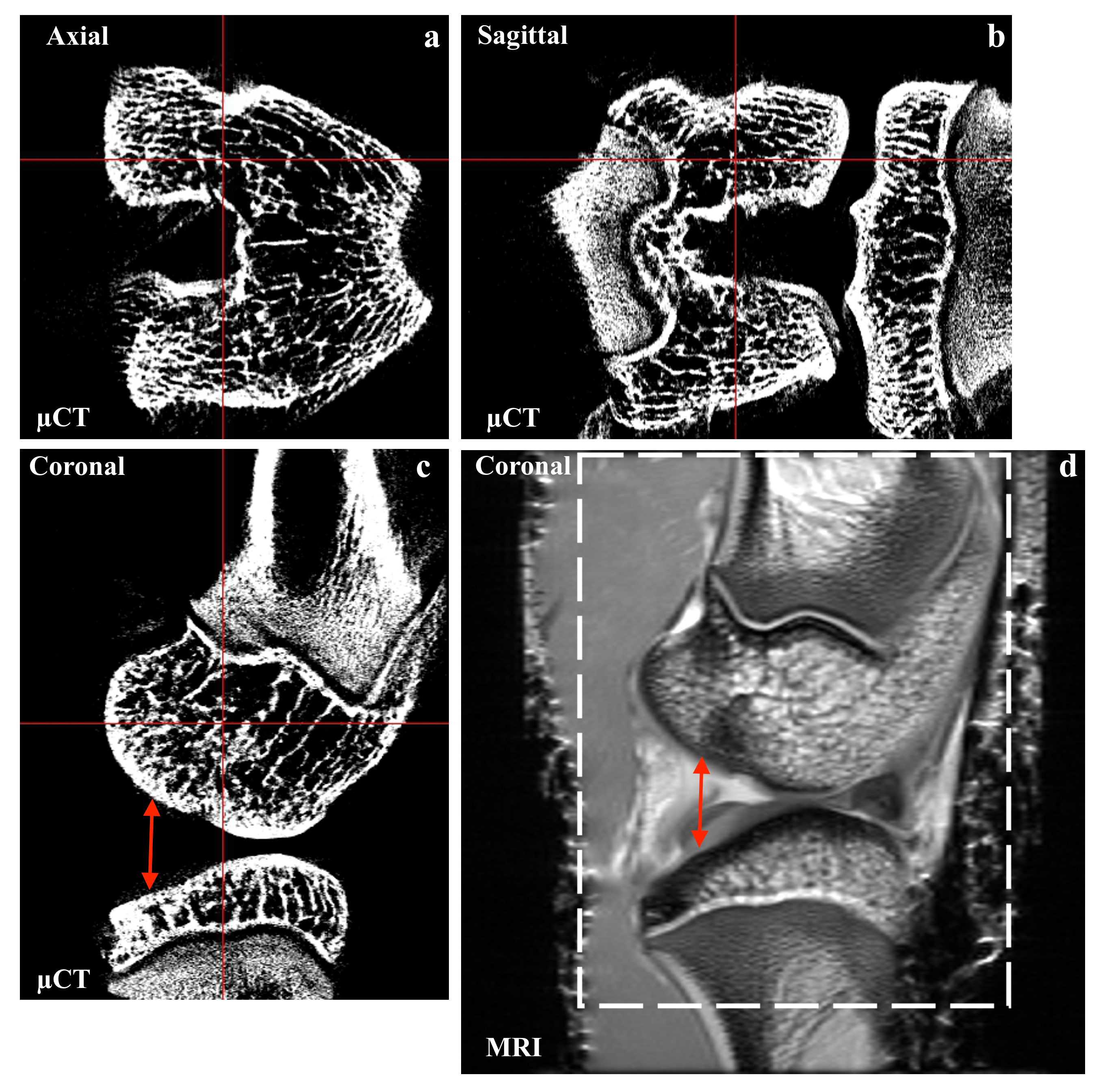 Two-dimensional high-resolution (isotropic)axial (a), sagittal (b), and ...