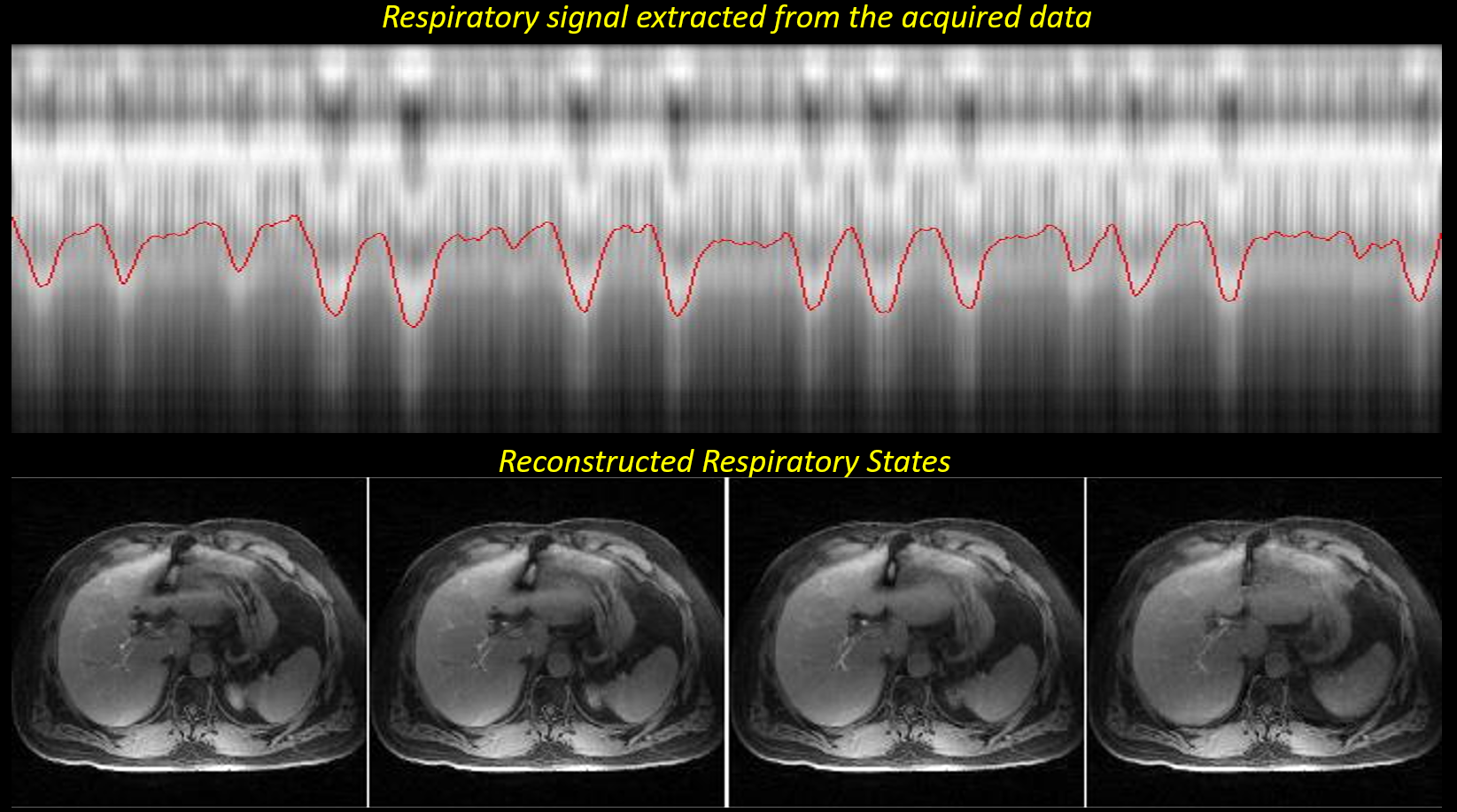 Figure 1: XD-GRASPreconstruction: The respiratory motion signal is ...