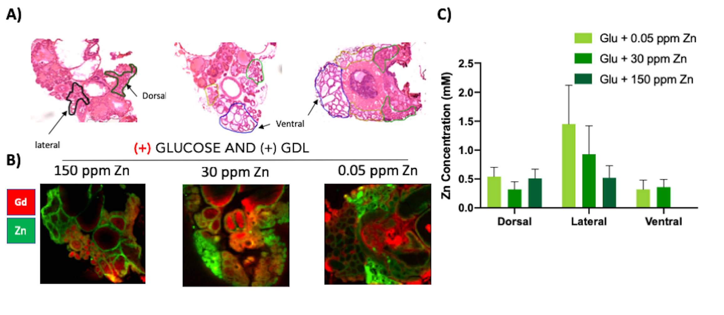 Molecular MRI and synchrotron radiation X-Ray fluorescence of zinc ...