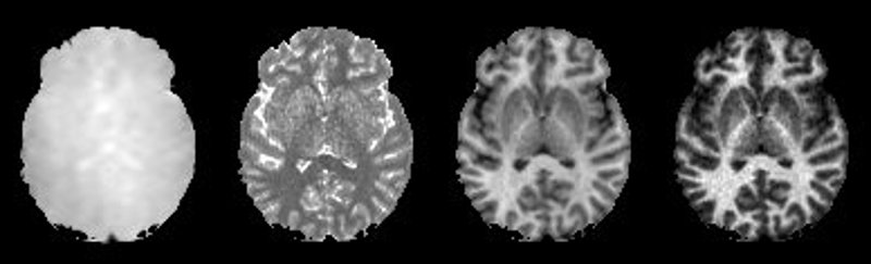 Figure 3: B1, T1, dual MTsat, and ihMTsat maps calculatedfrom a ...