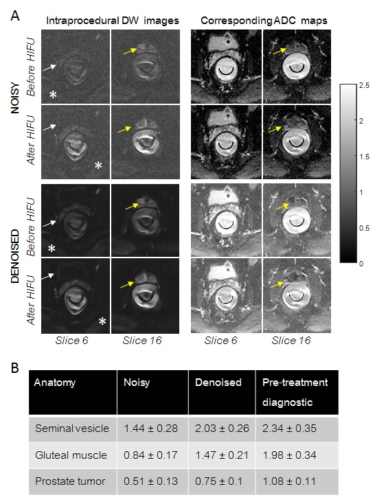 Elena Kaye 1 and Oguz Akin 2