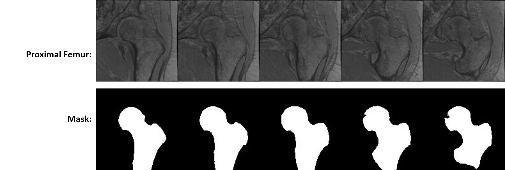 Figure 1: The high-resolution MRI image with the corresponding manually ...