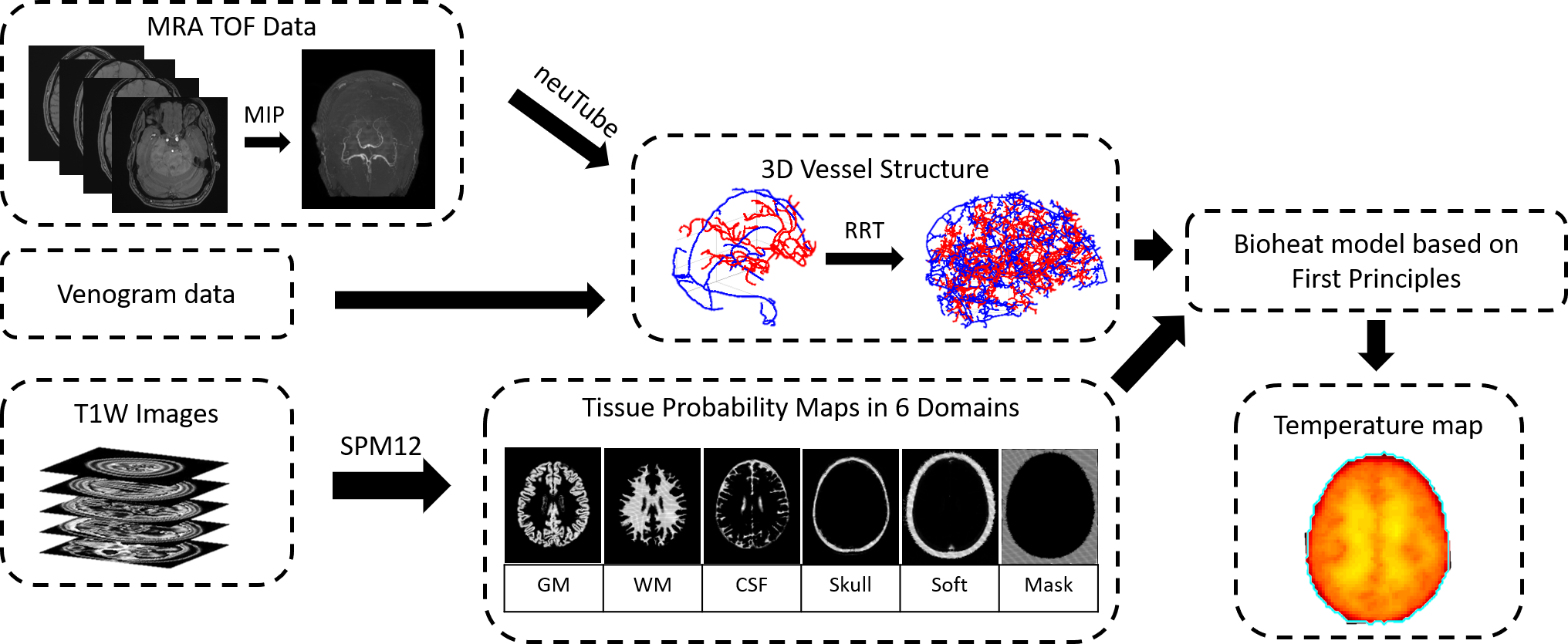 Figure 2. Schematicof subject-specific brain temperature modeling using individual MRI input data.