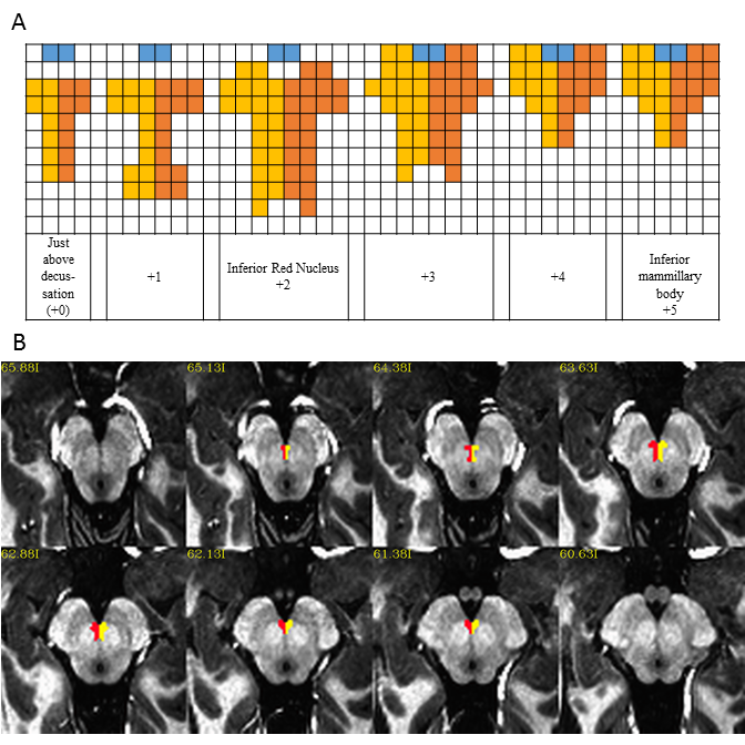 1 Imaging Institute, Cleveland Clinic Foundation, Cleveland, OH, United ...