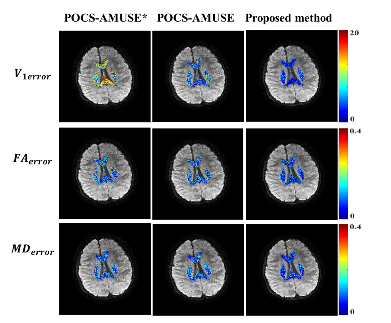 Figure4. Colored maps of the tensor error metrics for principal ...