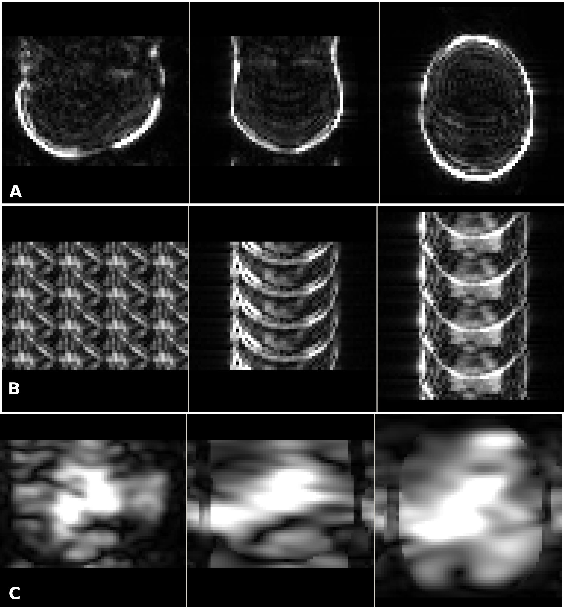 We present a Fast Online Reconstruction pipeline of 3D FatNav with ...