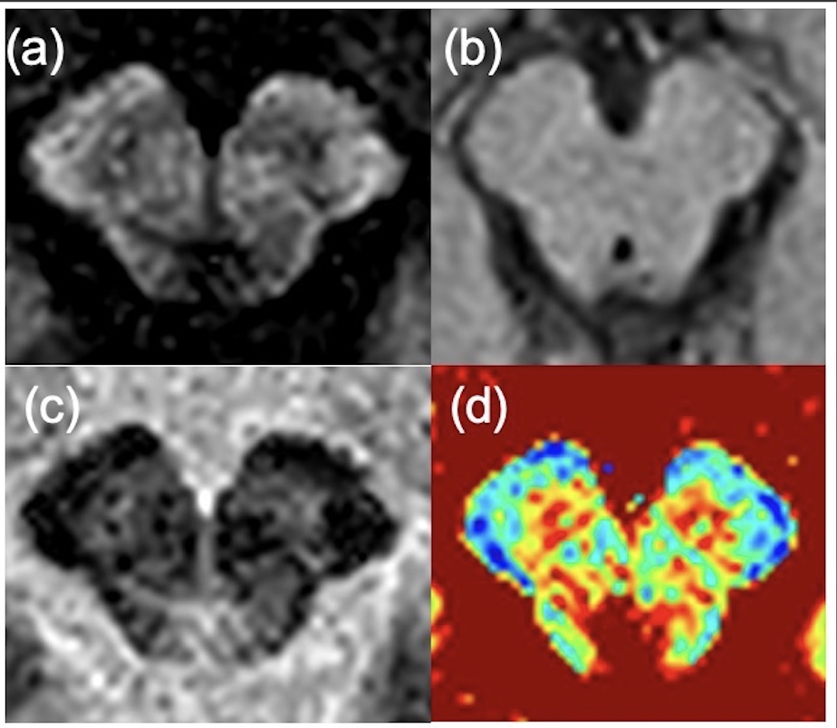 Fig. 1Representative images of the substantia nigra obtained from the ...