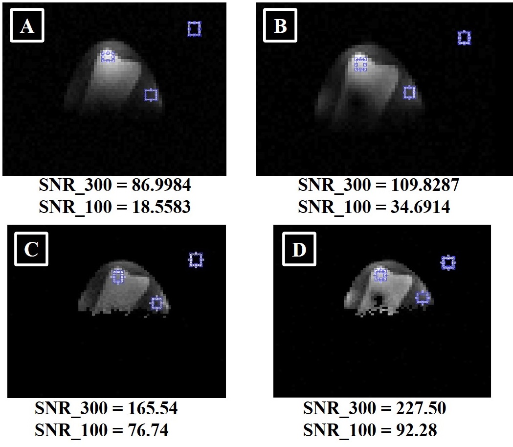 Figure1: Dimensions of the coil designed in CST (A). Thebreast coil was ...